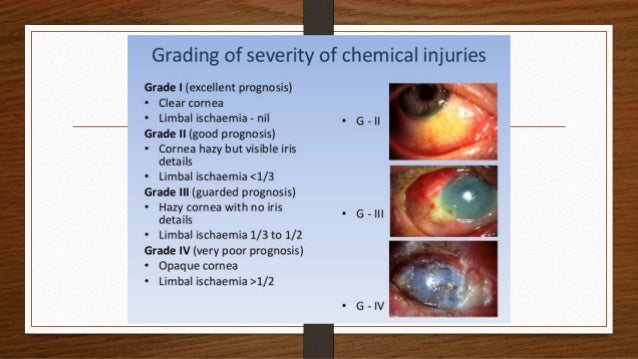 Chemical injuries of the eye