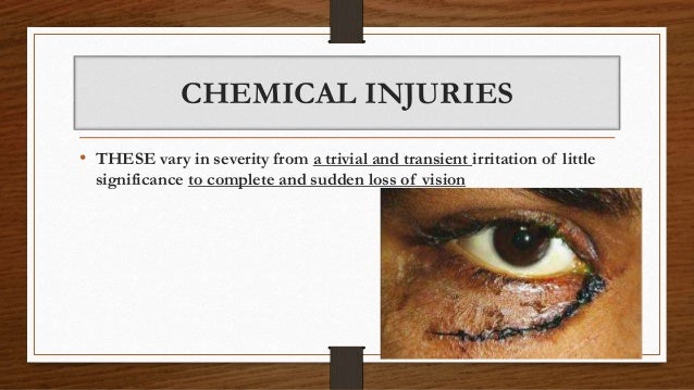 Chemical injuries of the eye
