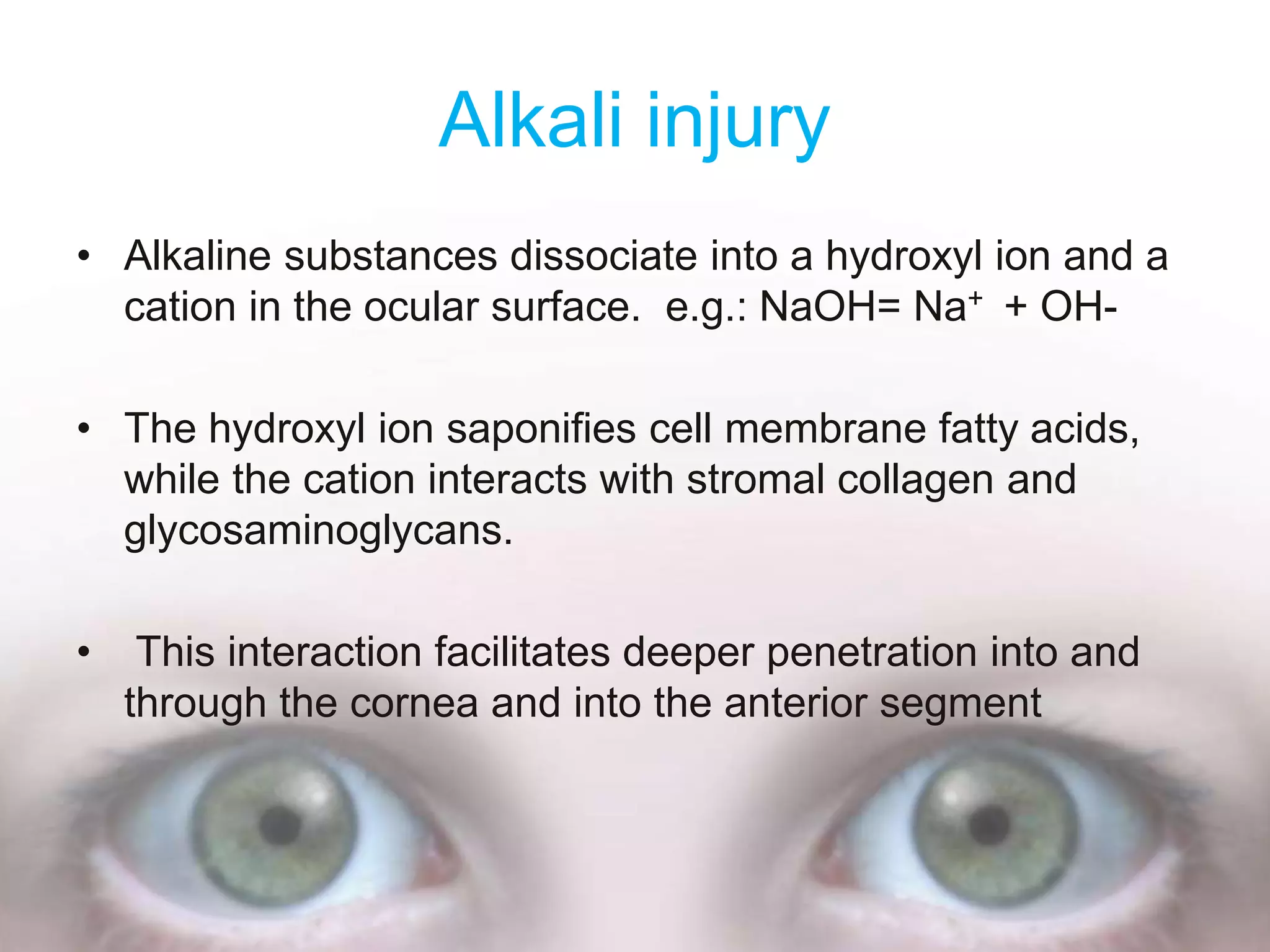Chemical injuries of the eye | PPTX