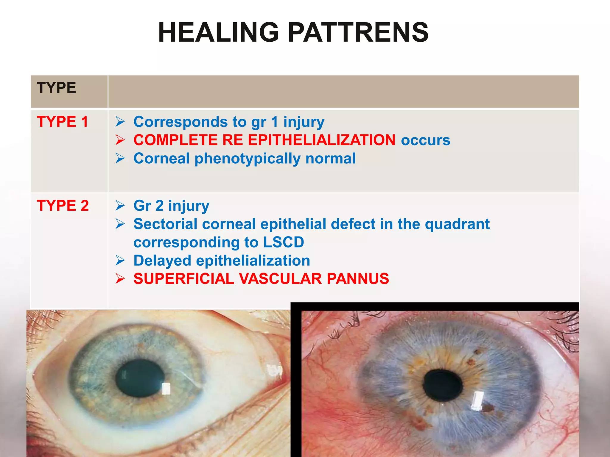 Chemical injuries of the eye | PPTX