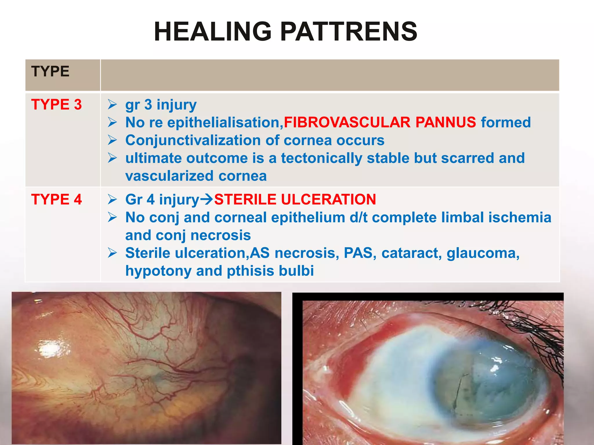 Chemical injuries of the eye | PPTX