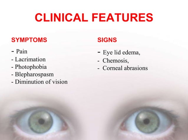 Chemical injuries of the eye | PPTX