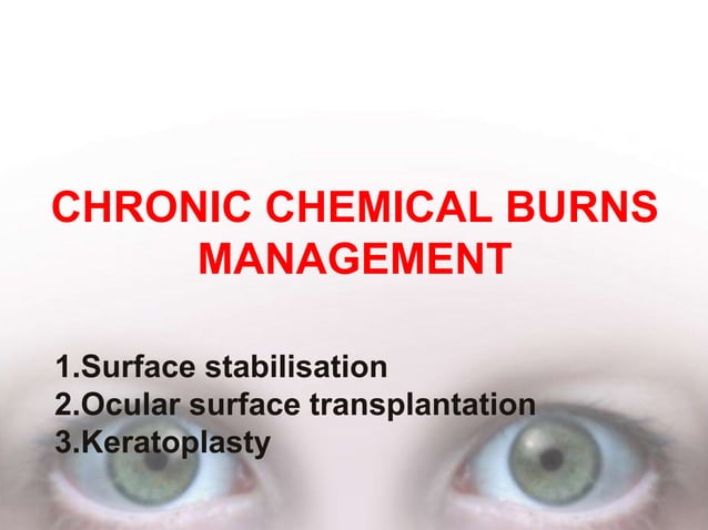 Chemical injuries of the eye | PPTX