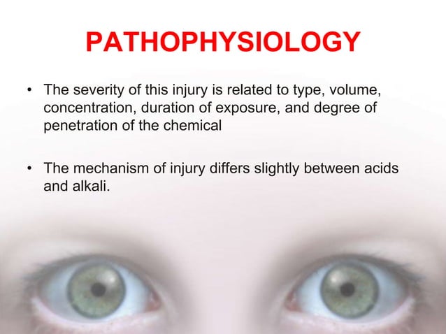 Chemical injuries of the eye | PPTX