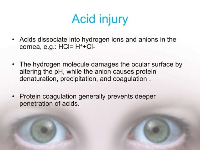 Chemical injuries of the eye | PPTX