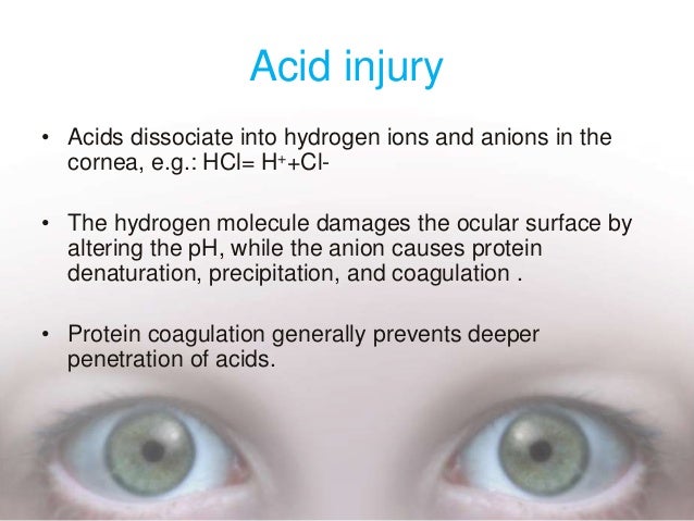 Chemical injuries of the eye
