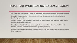 Ocular Chemical Injury | PPTX