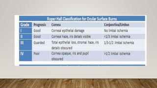 Ocular Chemical Injury | PPTX
