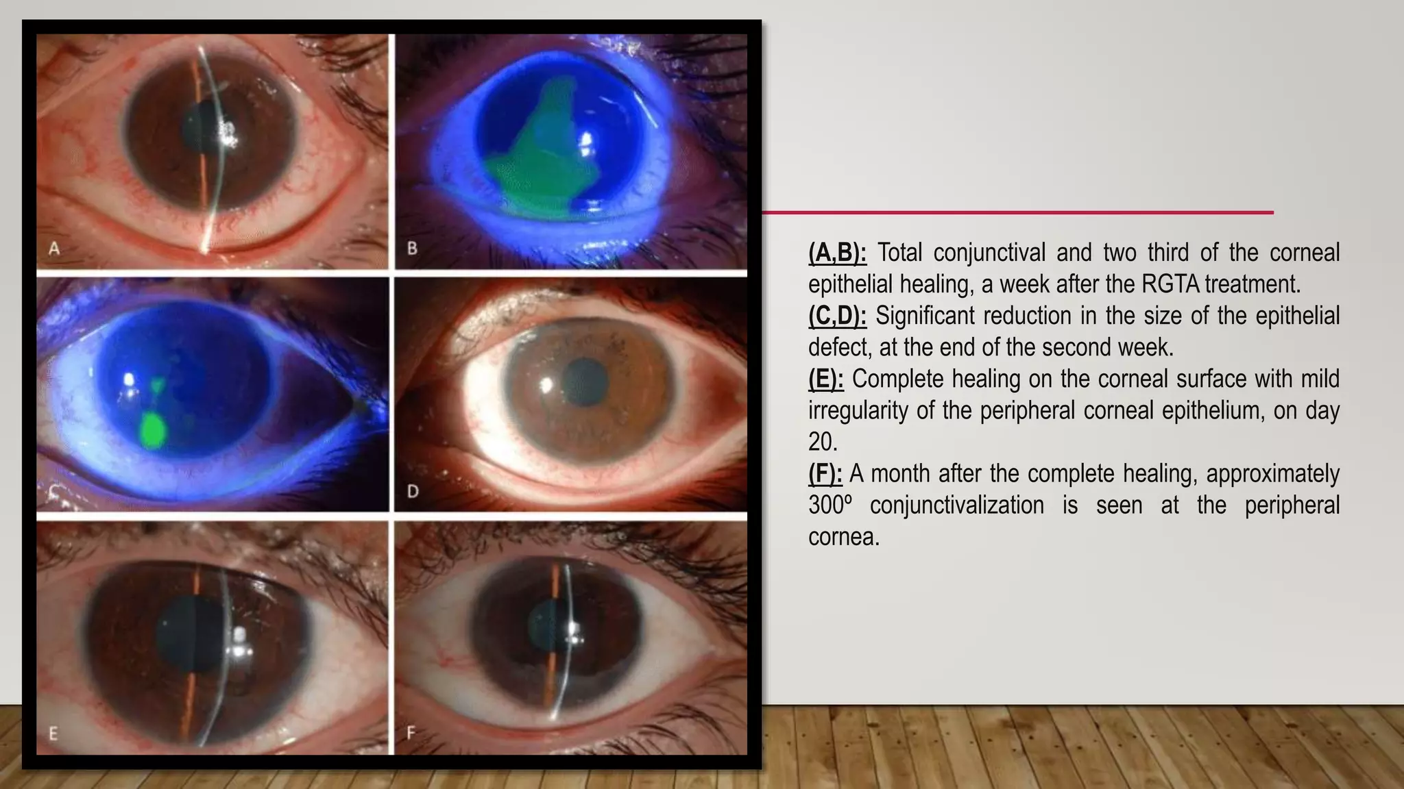 Chemical injury | PPTX