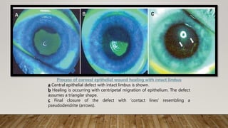 Chemical injury | PPTX