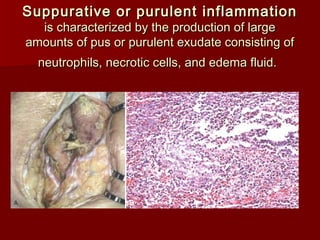 Chemical mediators | PPT | Blood Disorders | Diseases and Conditions