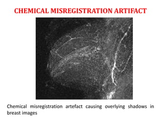 Chemical misregistration | PPTX