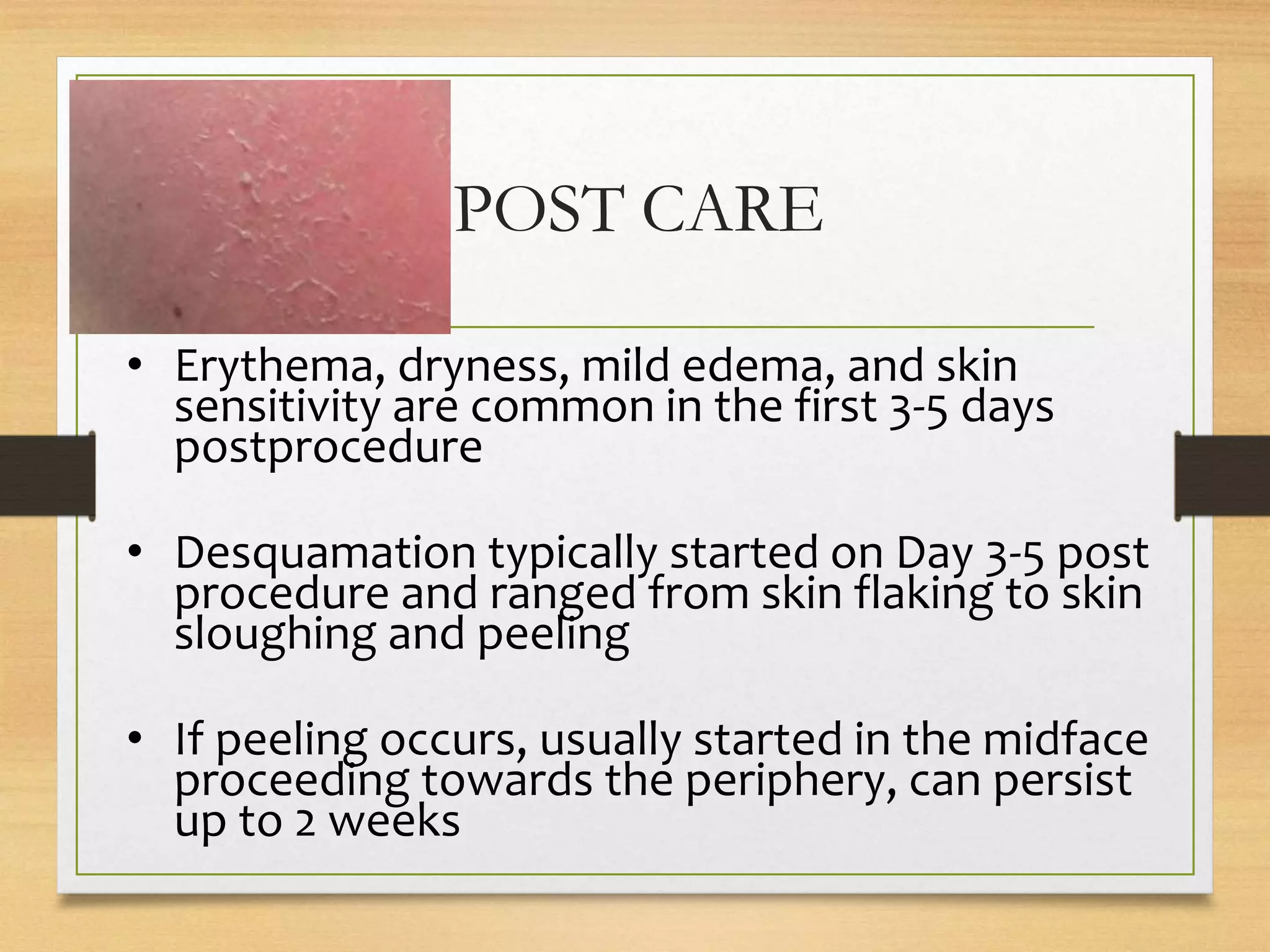 Chemical Peel.pptx