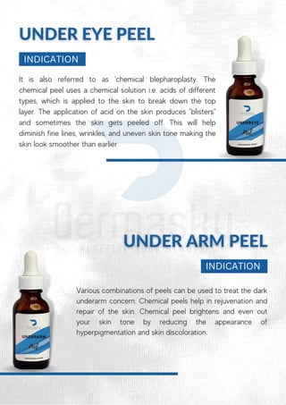chemical peels.pdf