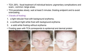 chemical peel treatment advances basic pg | PPTX