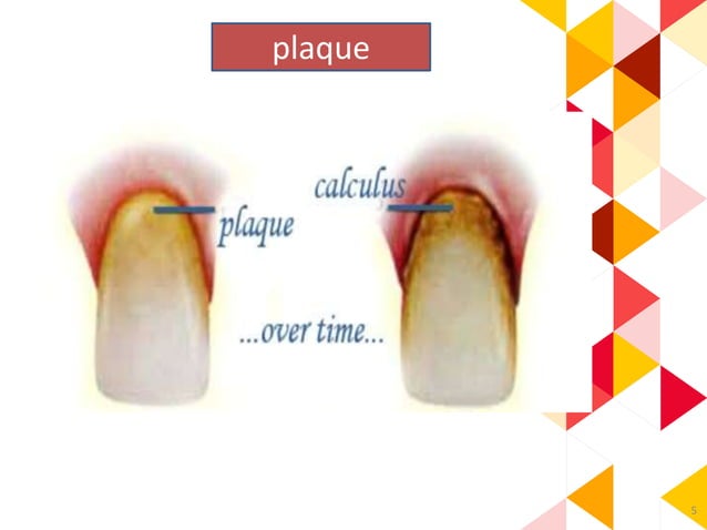 Chemical plaque control | PPTX | Dental Health | Diseases and Conditions
