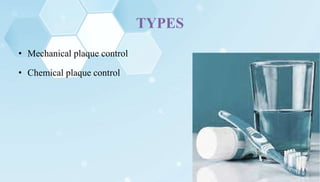CHEMICAL PLAQUE CONTROL.pptx