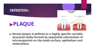 chemical plaque control as a method of plaque control.pptx