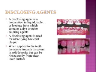 Chemical plaque control-31-12-14 (1) | PPT