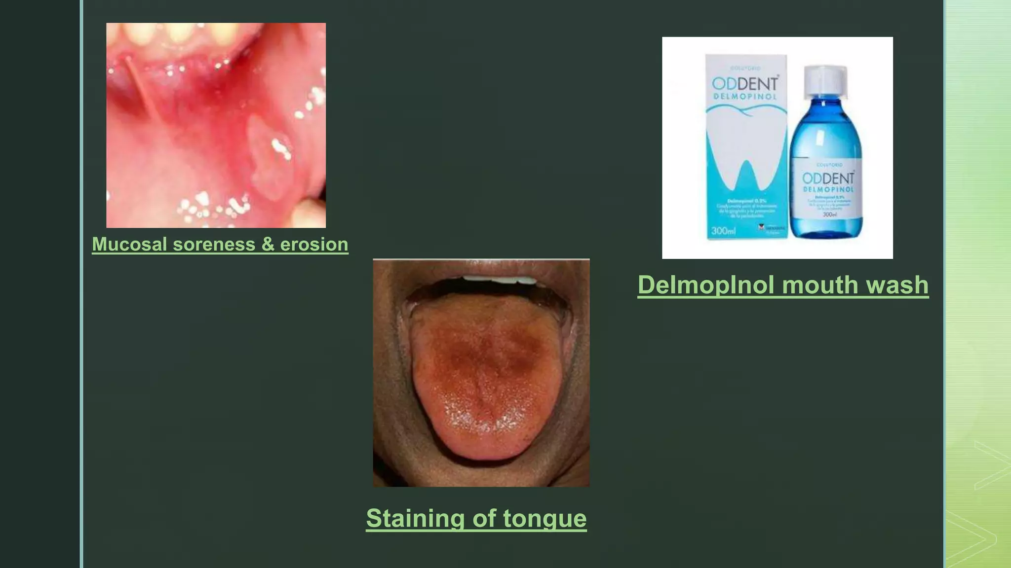 Chemical plaque control study | PPTX
