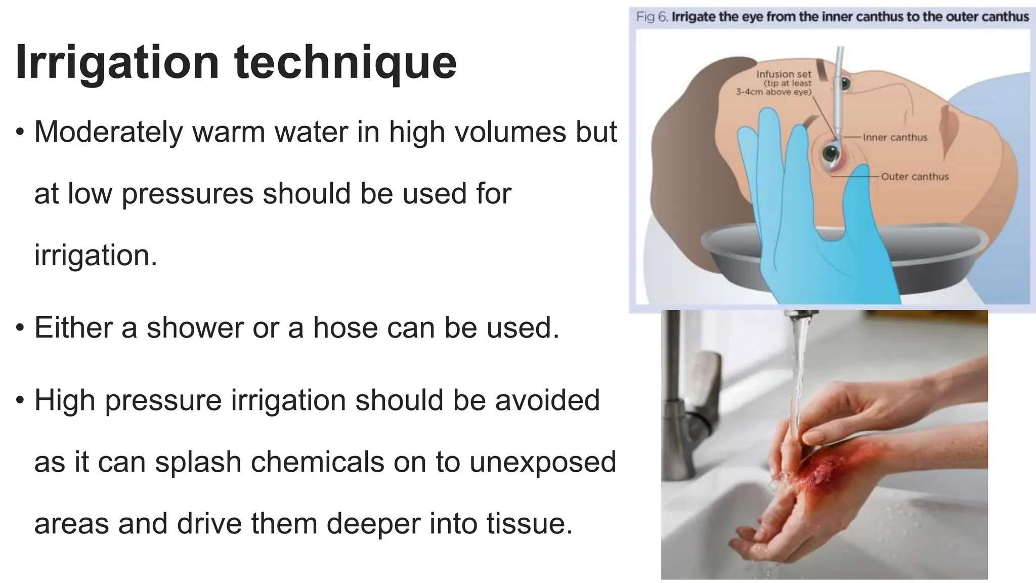 Chemical Spill And Chemical Burn Management.pptx
