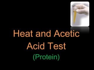Chemical tests for urine | PPT