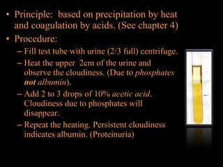 Chemical tests for urine | PPT | Blood Disorders | Diseases and Conditions