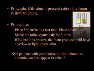 Chemical tests for urine | PPT | Blood Disorders | Diseases and Conditions