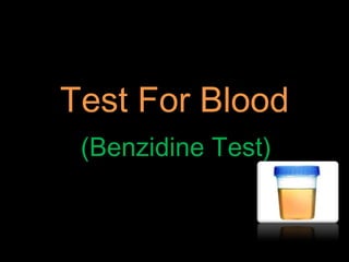 Chemical tests for urine | PPT | Blood Disorders | Diseases and Conditions
