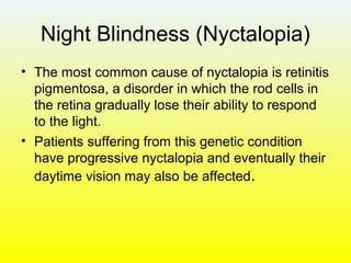 Chemistry of vision | PPT