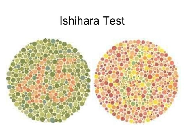 Chemistry Of Vision Final | PPT | Eye and Vision Conditions | Diseases ...