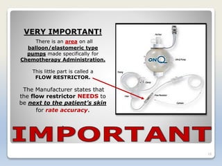 Chemo hook up ppt. | PPTX