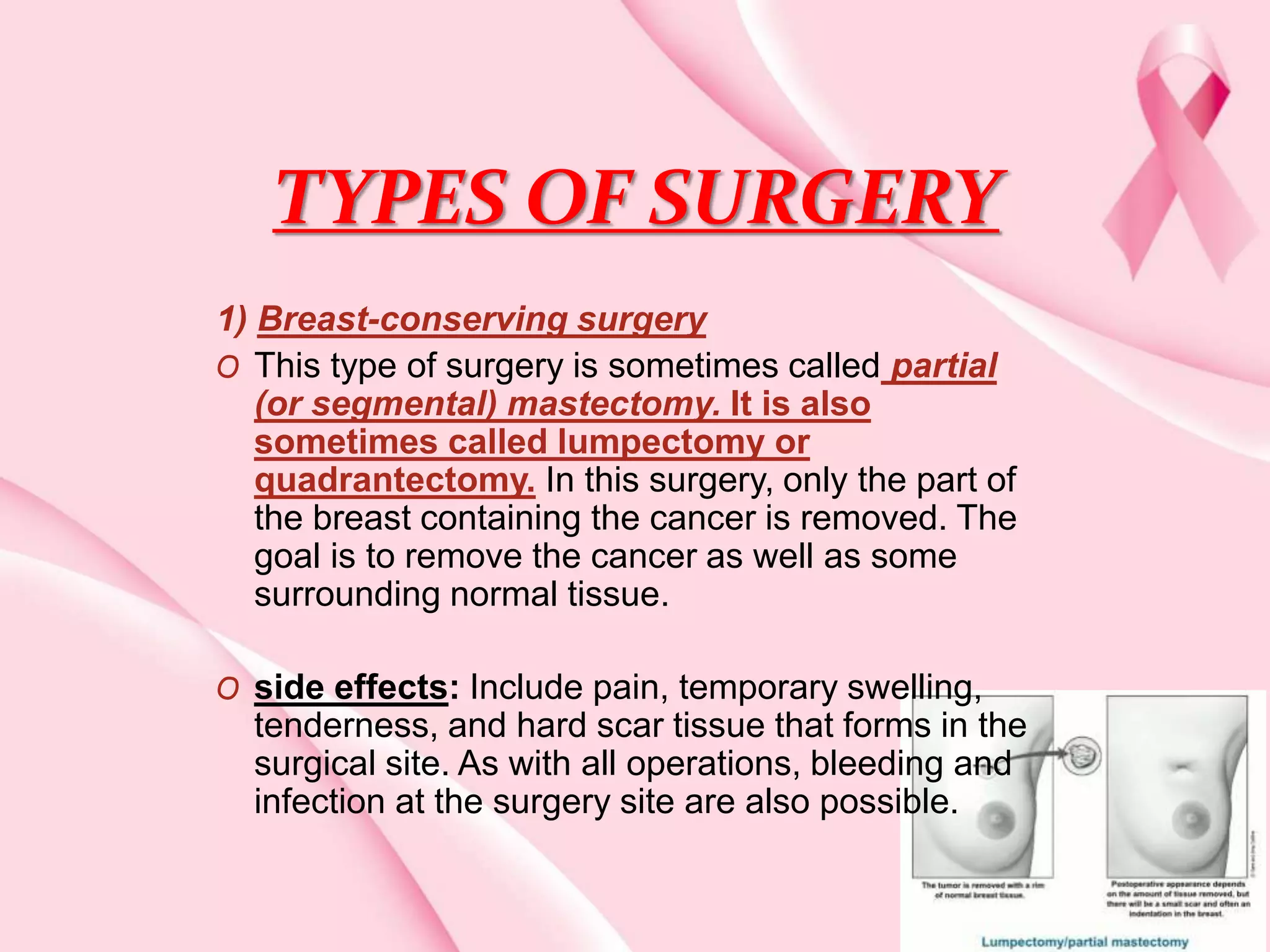 Chemotherapy of breast cancer | PPTX