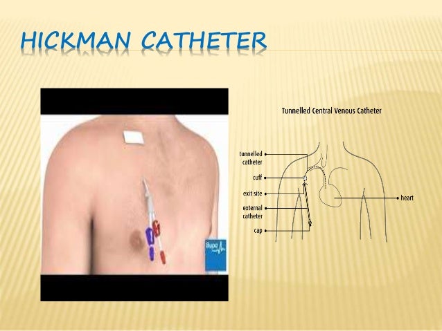 Chemotheray nsg role