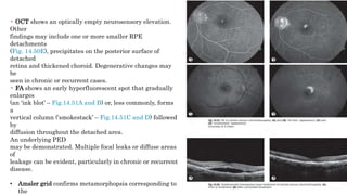 Macular dystrophies introduction to latest diagnostic method | PPTX