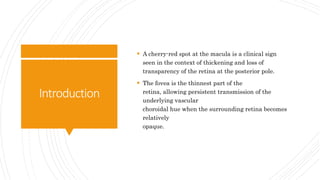 Macular dystrophies introduction to latest diagnostic method | PPT