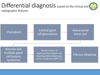 Cherubism "case presentation " | PPTX