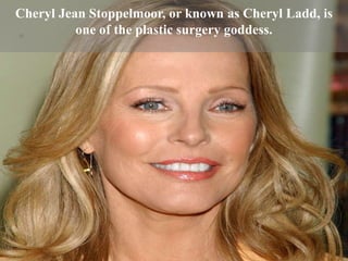Cheryl Ladd Plastic Surgery Before And After
