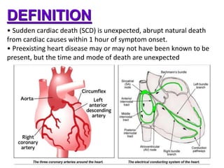 Chesam Sahid Ahmad 405(a) siw 12 internal.pptx