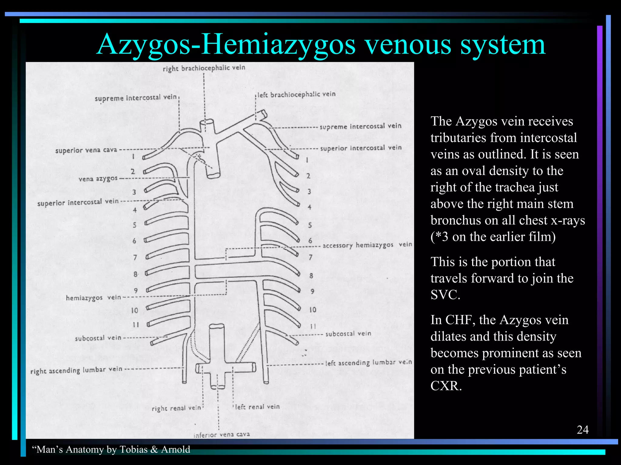 Chest X-ray anatomy | PPS