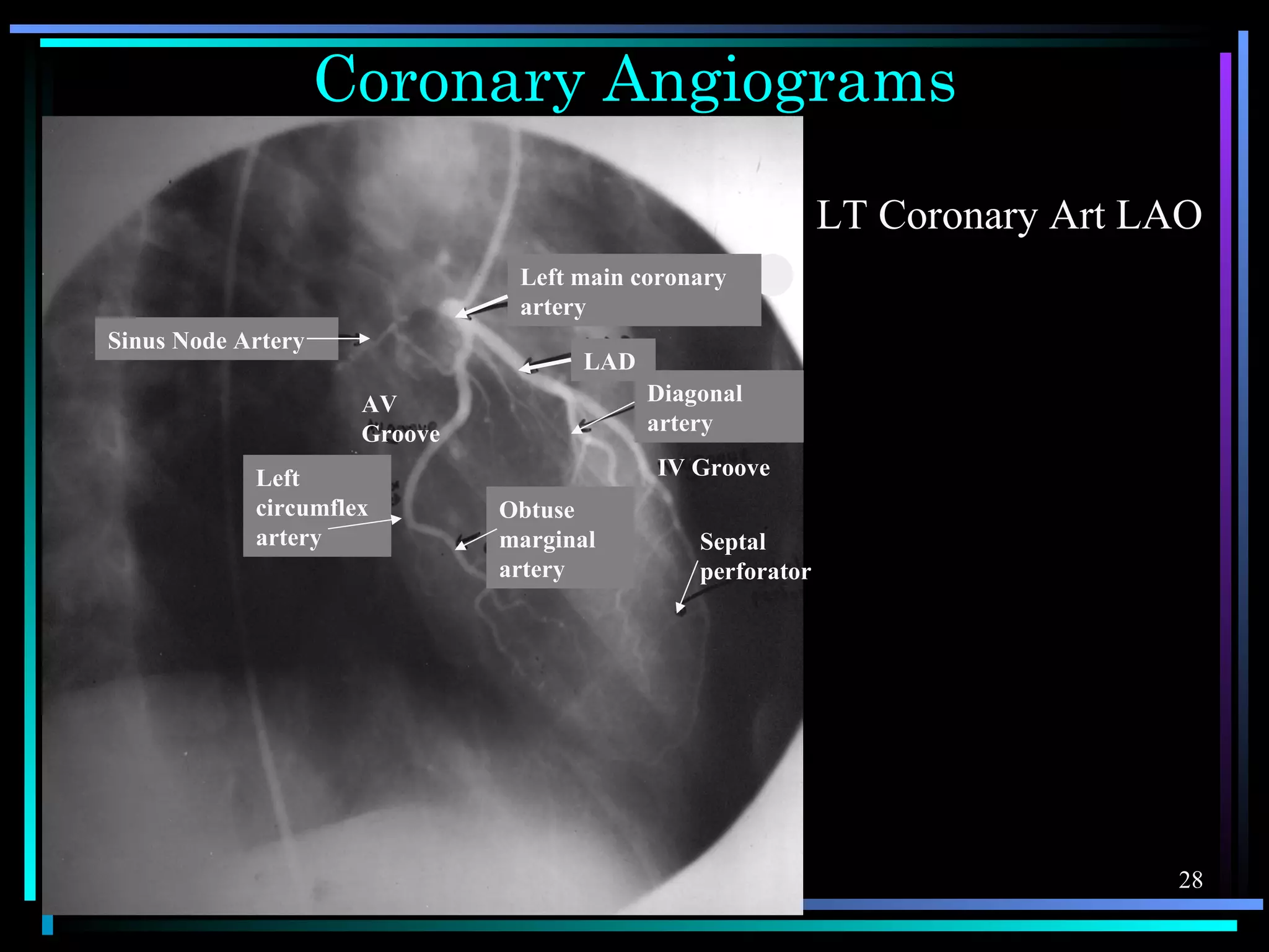Chest X-ray anatomy | PPS