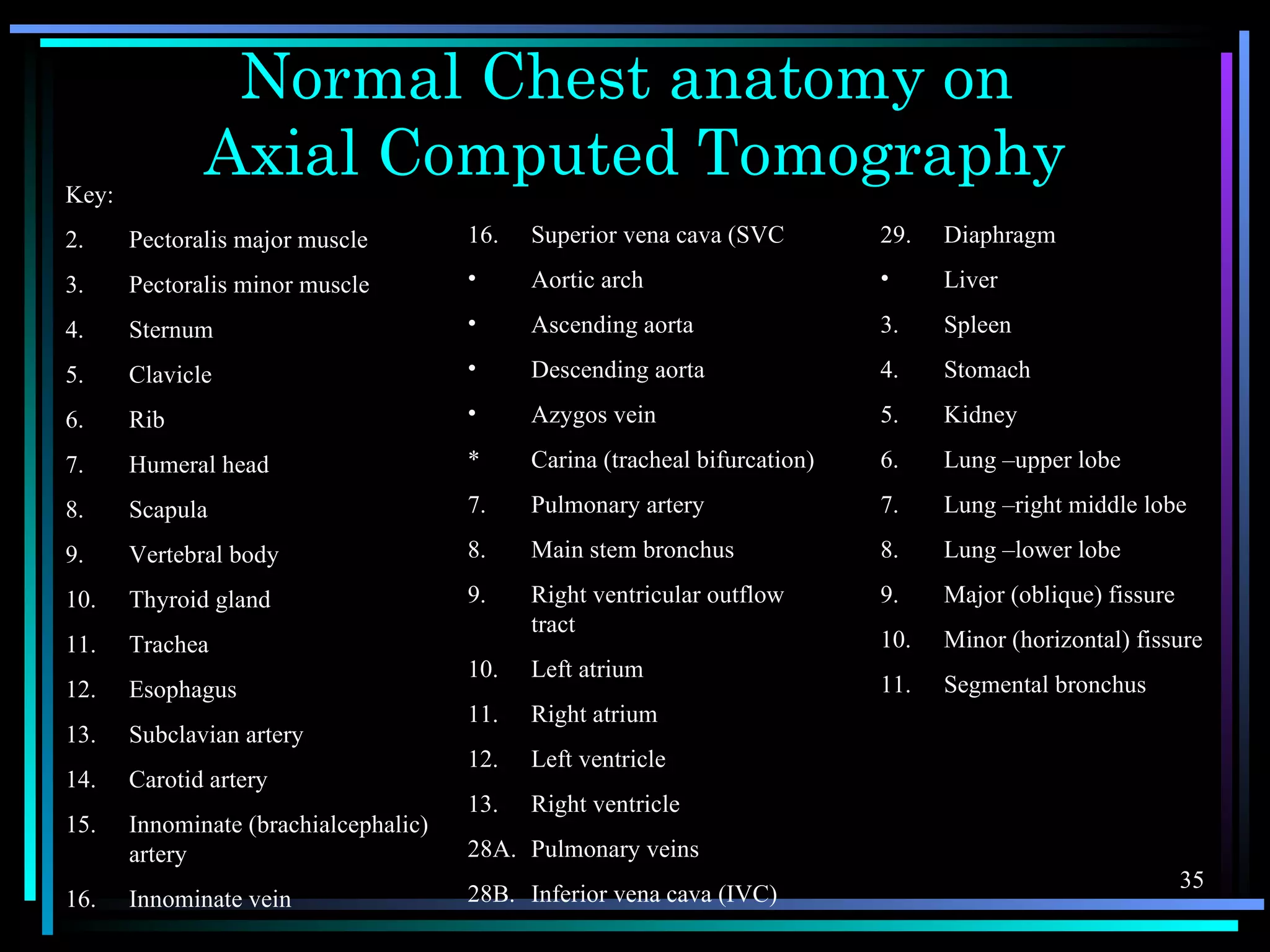 Chest X-ray anatomy | PPS