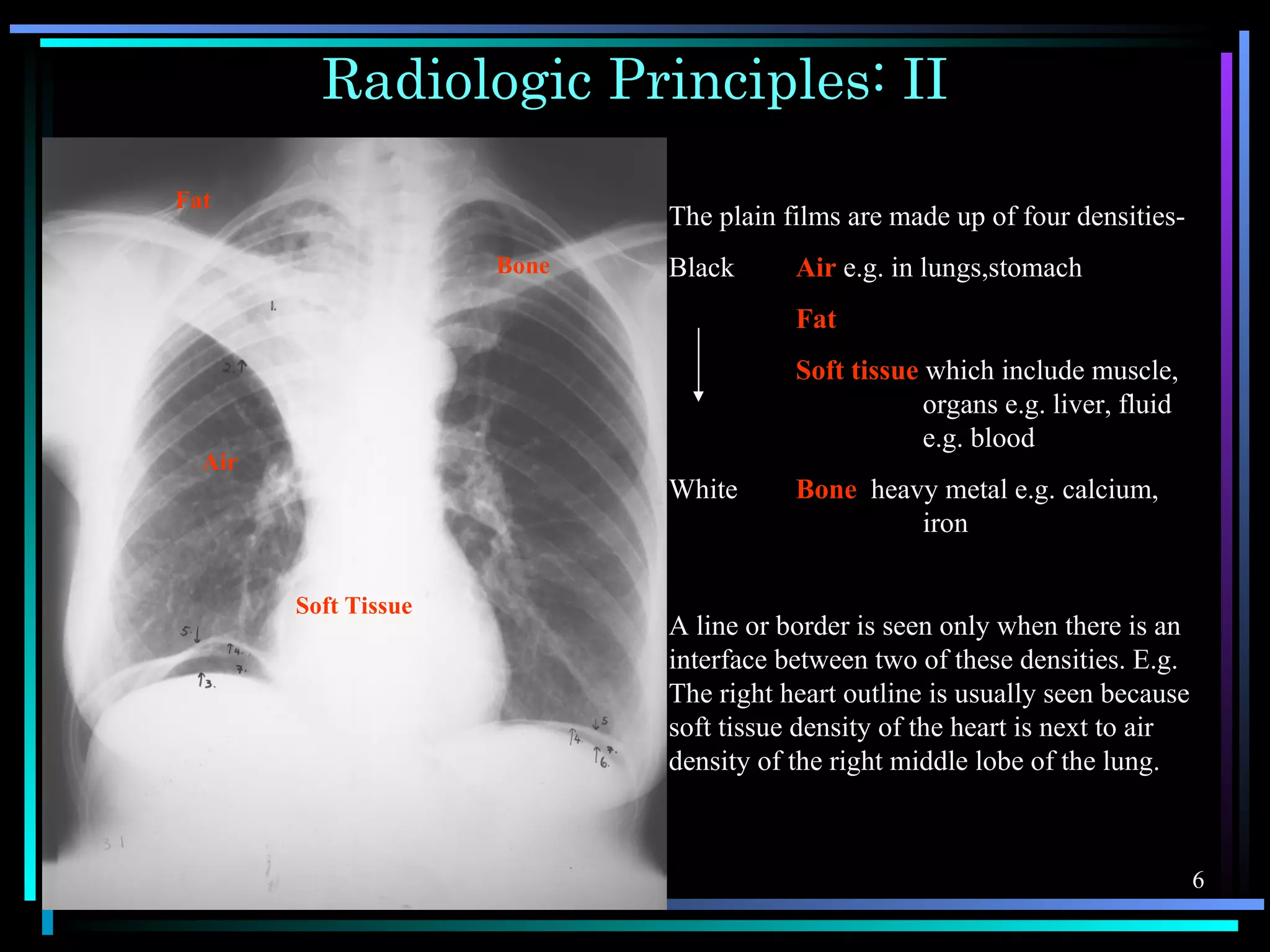 Chest X-ray anatomy | PPS