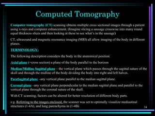 Chest X-ray anatomy | PPS