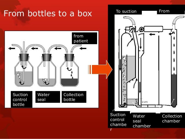 Chest Drain Managment