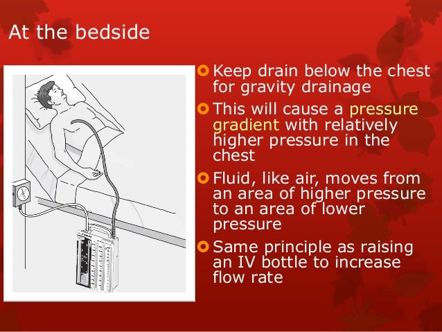 Chest Drain Managment