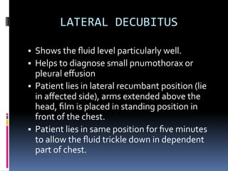chest examination.pptx.pdf