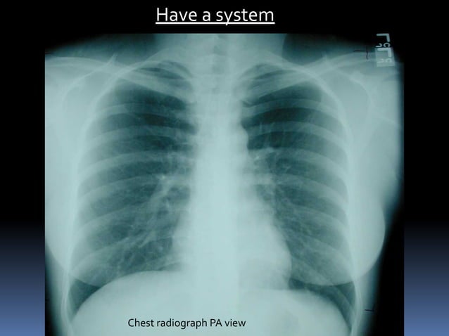 chest examination.pptx.pdf