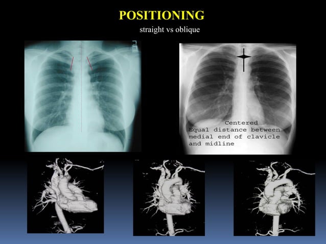 chest examination.pptx.pdf