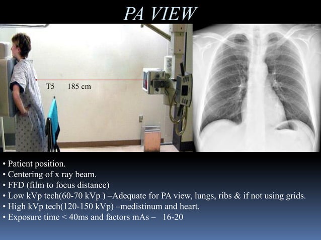 chest examination.pptx.pdf